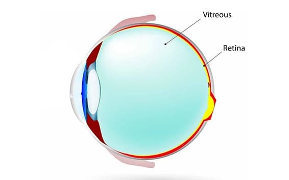 Best Eye Hospital